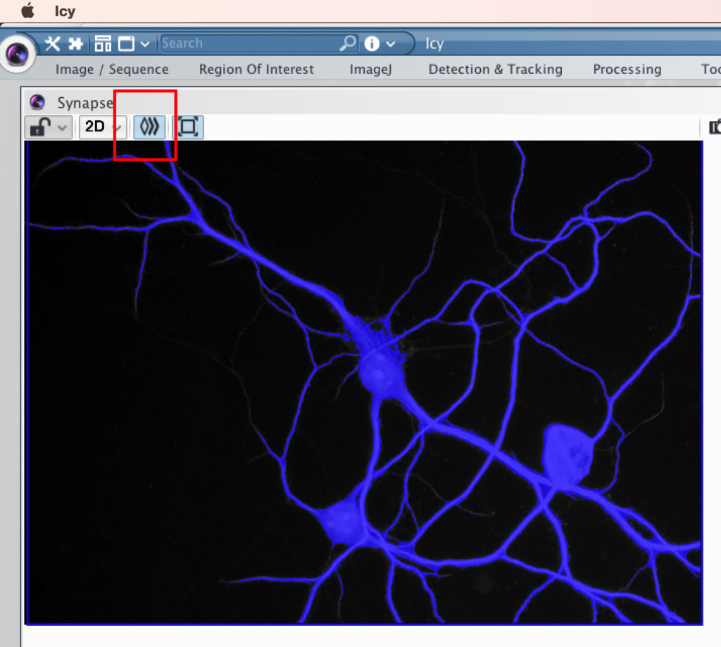 Easy Cell shape with HK-Means | – Open Source Image Processing Software
