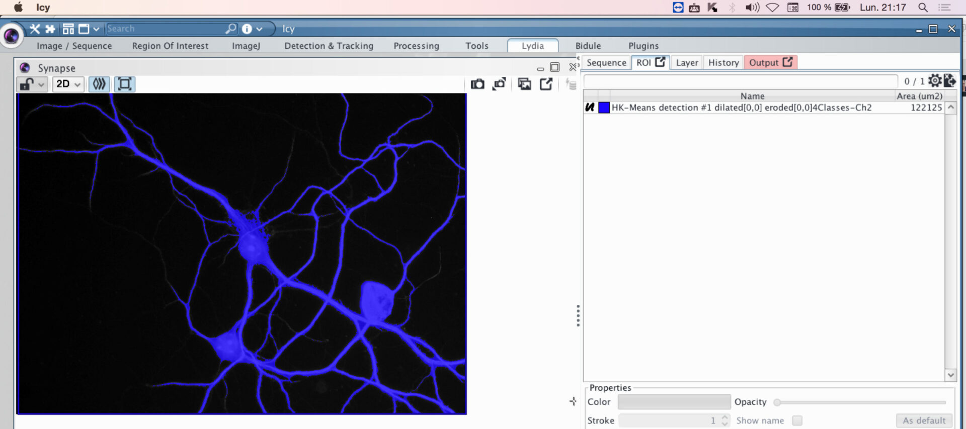 Easy Cell shape with HK-Means | – Open Source Image Processing Software
